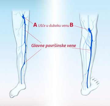 Bauerfeind Srbija » Varikozne vene i njihova prevencija